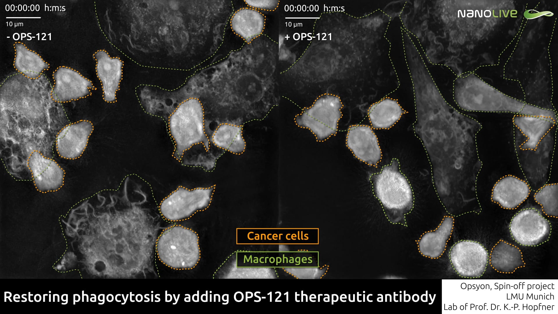 Phagocytosis Microscope